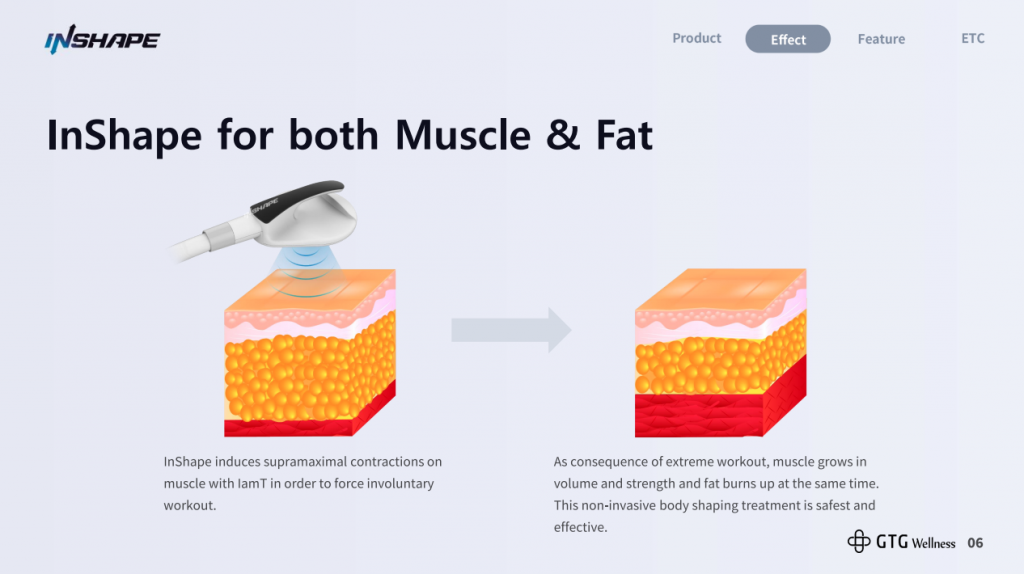 InShape – Bay Medical Systems